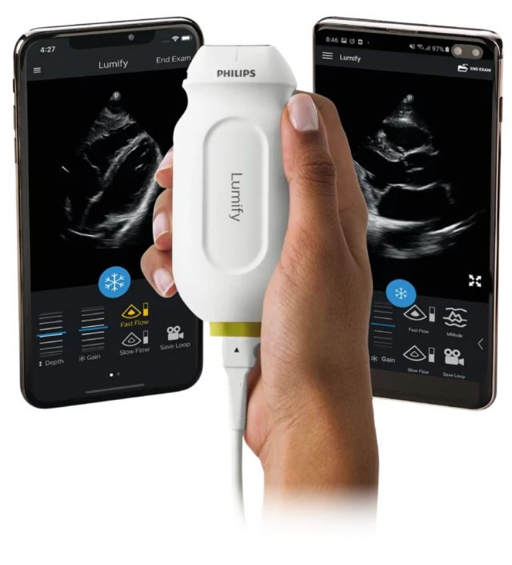 Ultrassom Lumify Philips - Tecnomédica