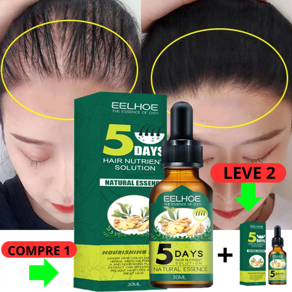 Forte Hair ACABA COM A QUEDA - COMPRE 1 LEVE 2 - Velox